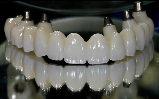 B&D Dental Technologies | Dental Milling Pucks — Proto3000 Online Store