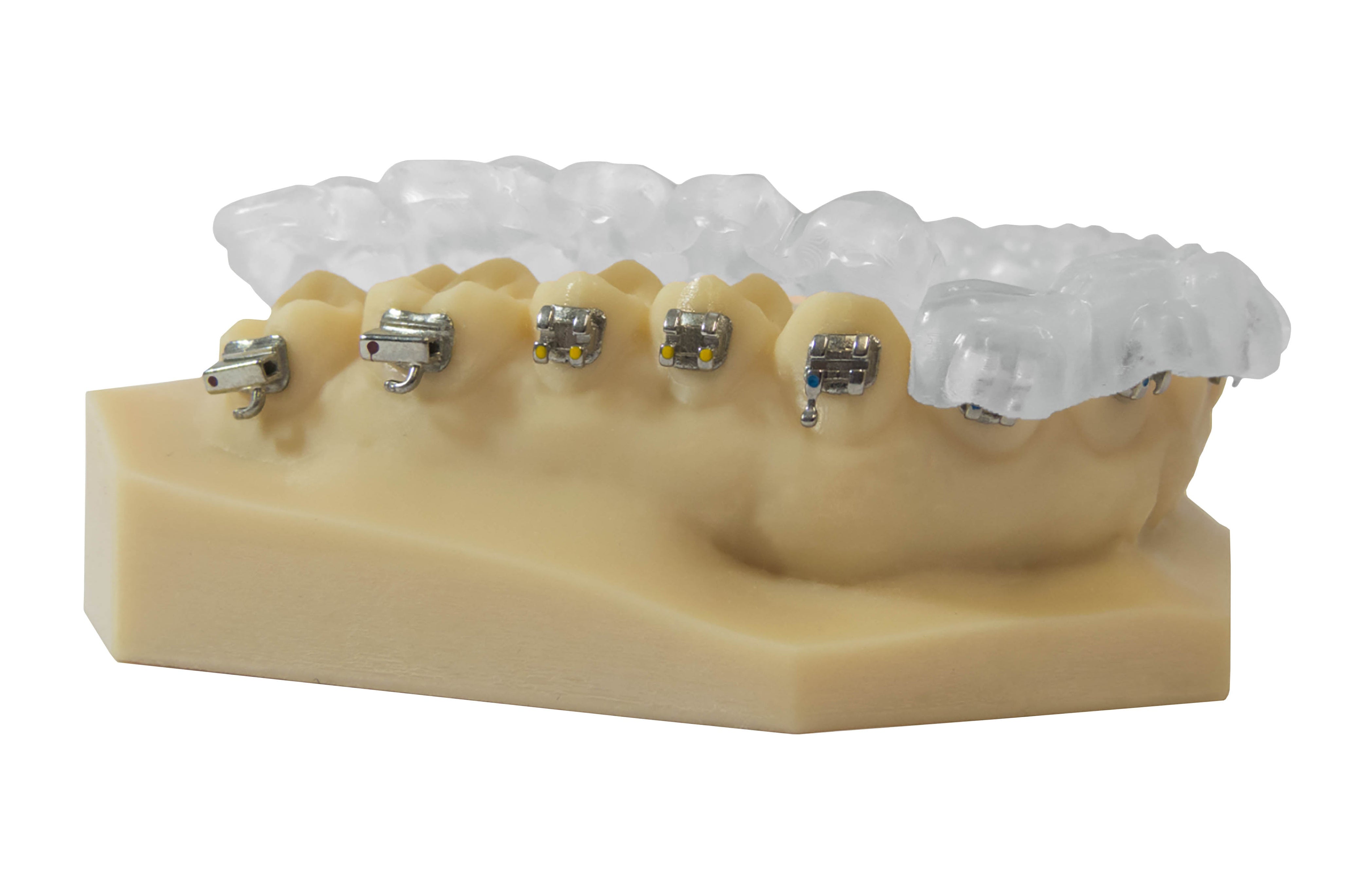 Keystone KeyPrint KeyOrtho IBT™ | Resin for Indirect Bonding Trays ...