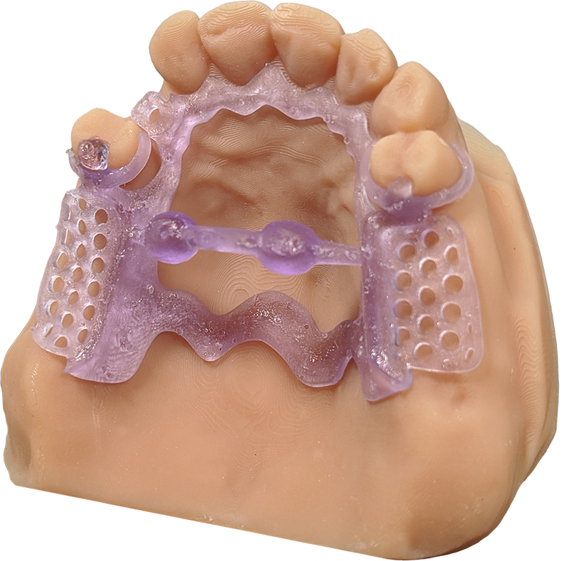 Buy Keystone KeyPrint KeyCast® Dental 3D Printing Resin — Proto3000 ...